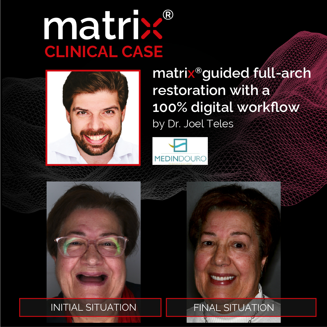 matrix® guided full-arch restoration with a 100% digital workflow - Dr ...