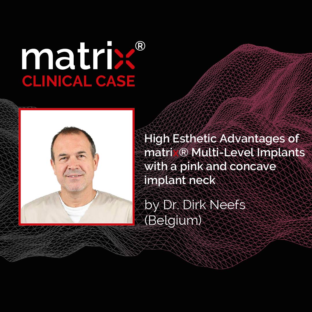 High Esthetic Advantages of matrix® Multi-Level Implants with a pink ...